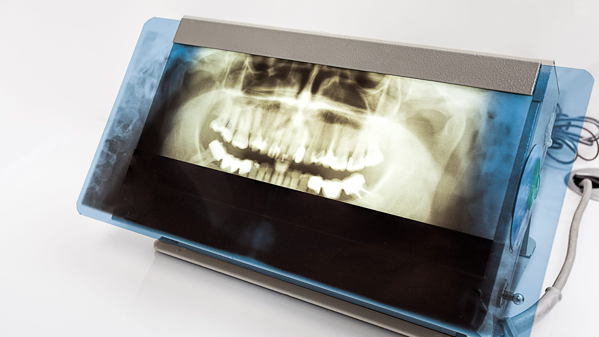 Diseño CAD de prótesis dentales para laboratorios - Forcad