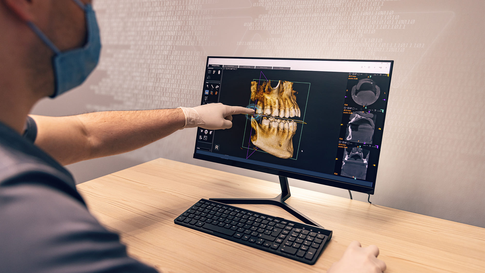 Cursos Exocad a medida para protésicos dentales - Forcad